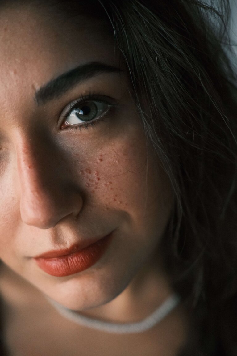 Demystifying Skin Discoloration - Free Bunni