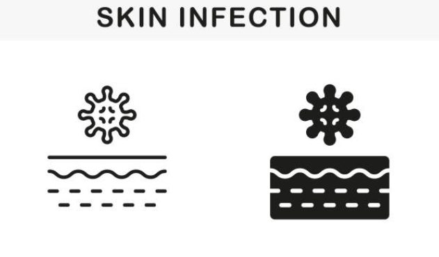 Exploring the Impact of Bacteria on Healthy Skin Function - Free Bunni
